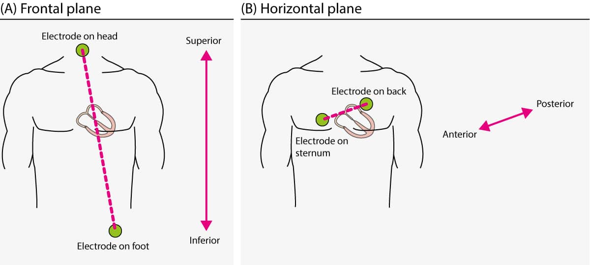 Figure 15. Schematic view of the angle of limb and chest leads. – The ...