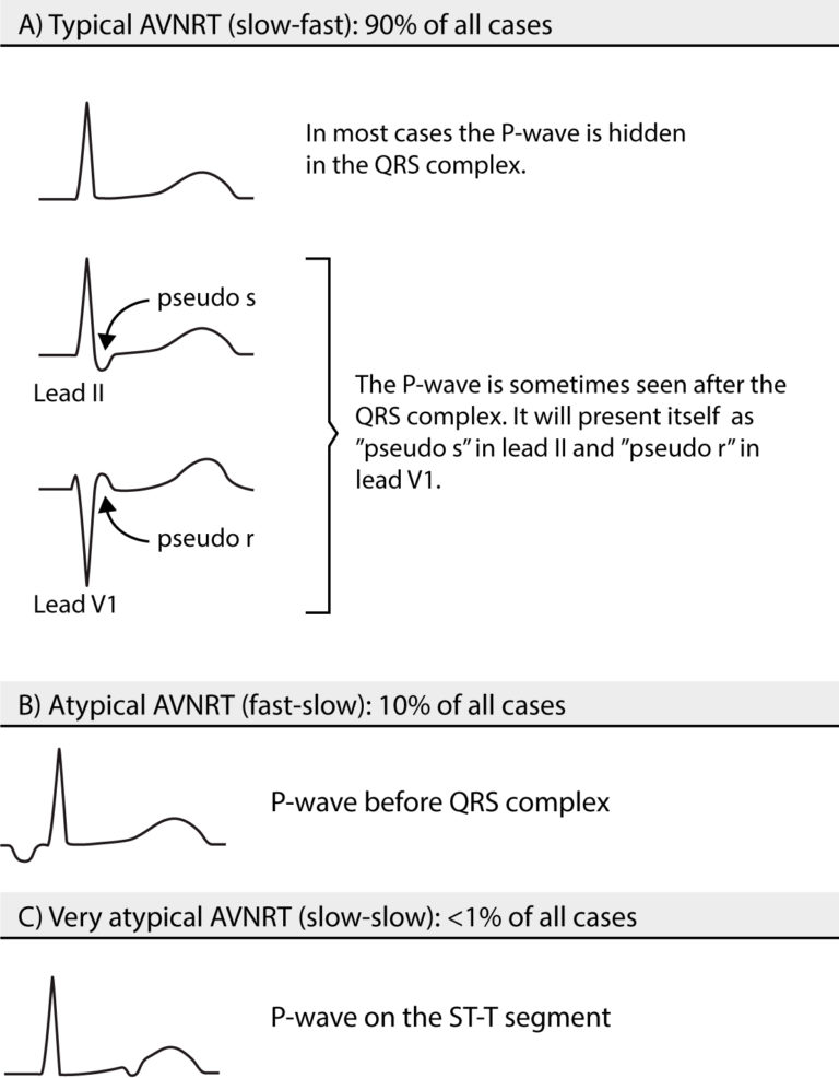 Clinical Electrocardiography (ECG) Interpretation