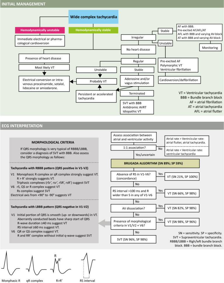 Diagnosis and management of narrow and wide complex tachycardia