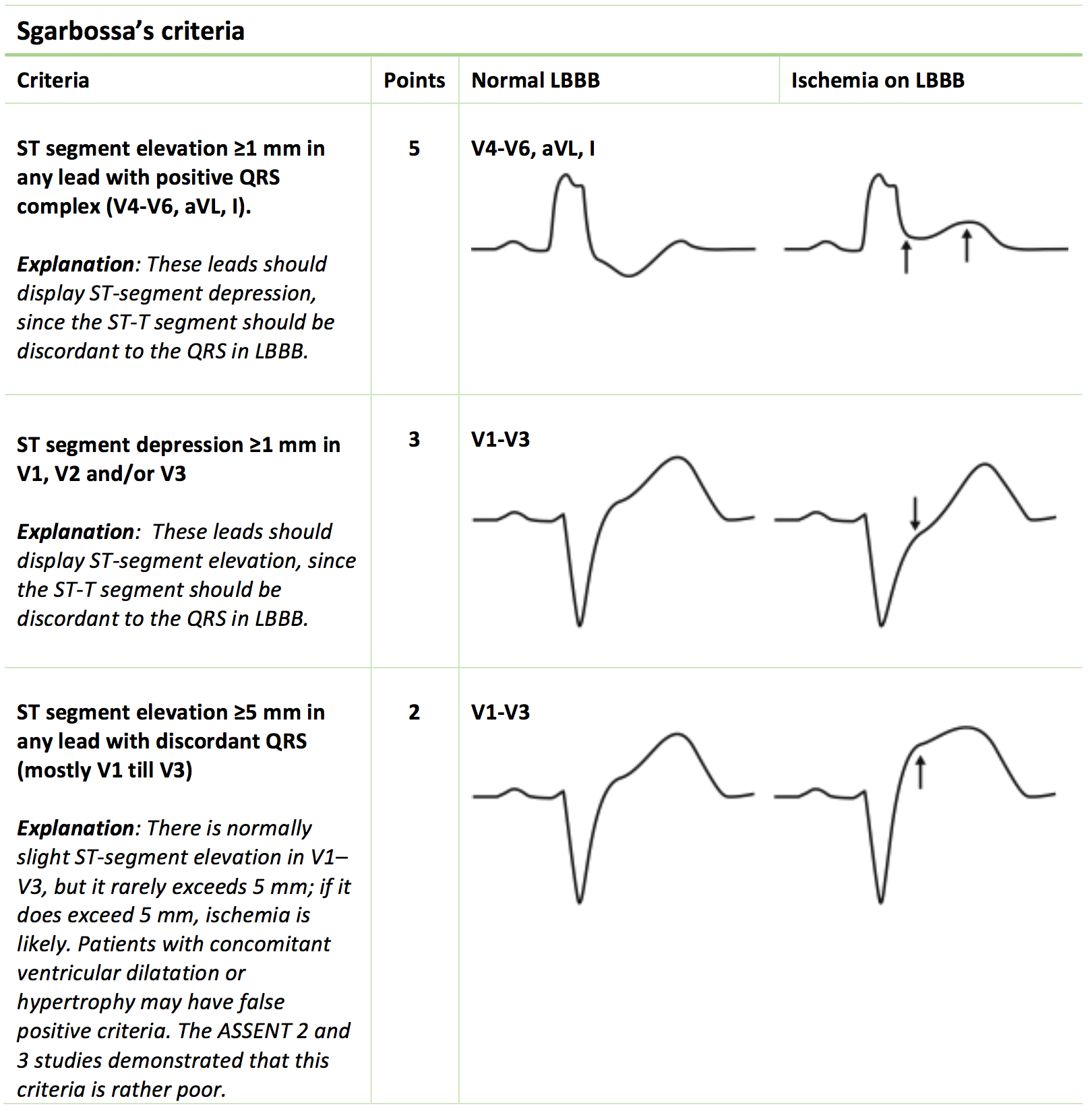 Table 1. Sgarbossa’s criteria. – The Cardiovascular