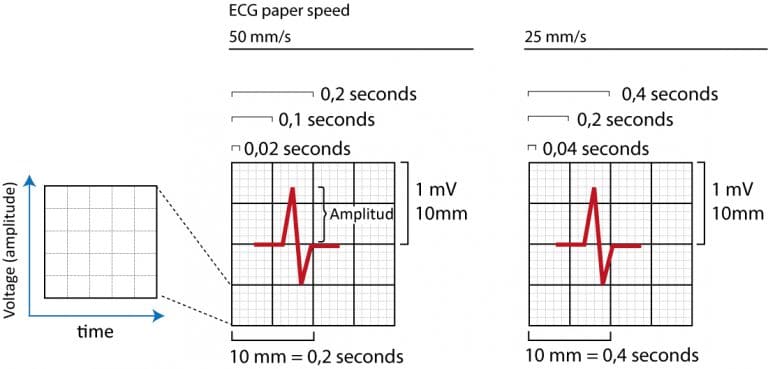 Pediatric aspects of ECG leads & anatomy