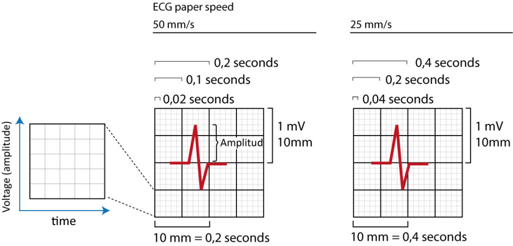 Figure 15. The ECG grid. – The Cardiovascular