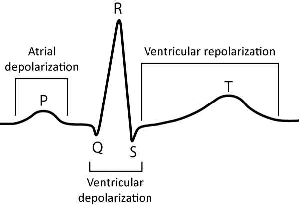 Figure 7. The classical ECG curve and the events reflected on it. The ...