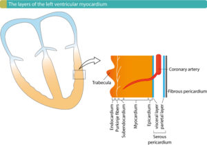STEMI (ST Elevation Myocardial Infarction): diagnosis, criteria, ECG ...