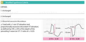 Left bundle branch block (LBBB) in acute myocardial infarction: the ...