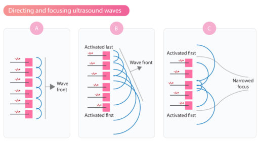 Optimization of the ultrasound image