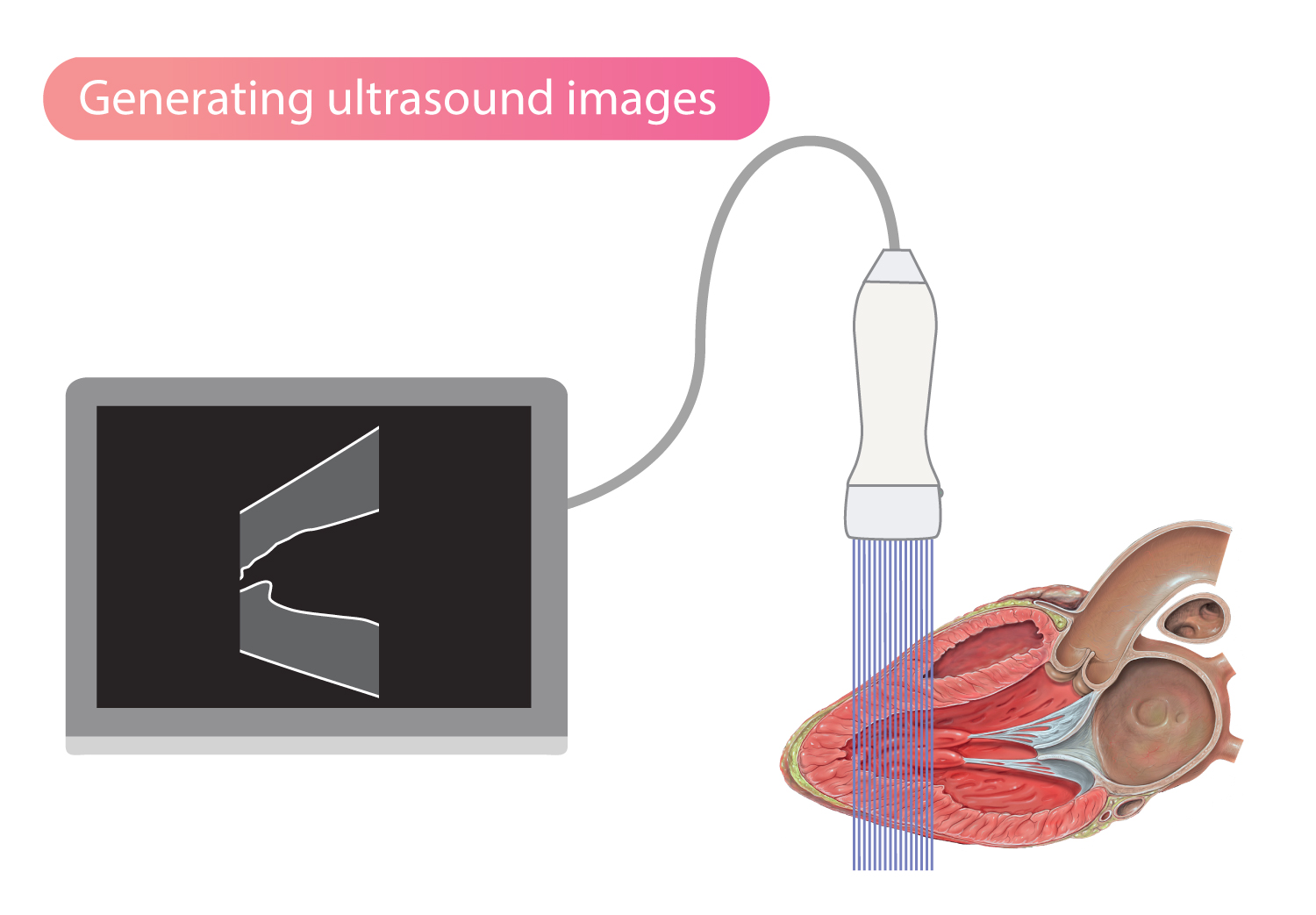 Technical aspects of the ultrasound image
