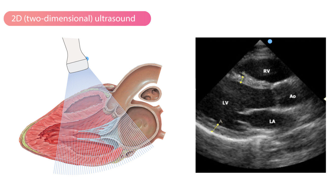 Clinical Echocardiography