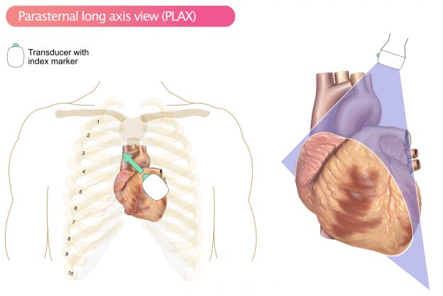 Standard Transthoracic Echocardiogram: Complete Imaging Protocol