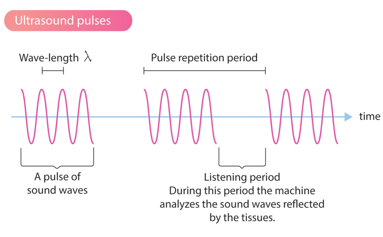 ultrasound-echocardiography-pulse-repetition-frequency-period – The ...