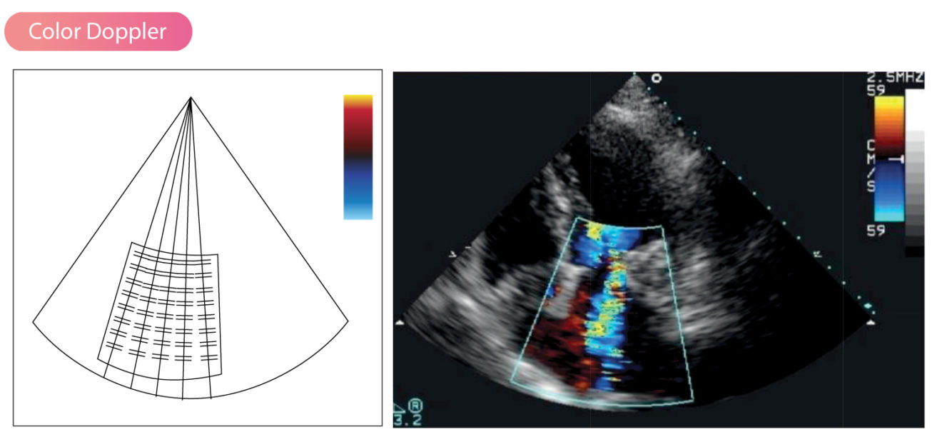Clinical Echocardiography