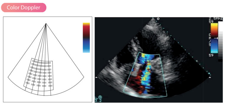 Color Doppler