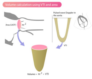 Stroke Volume, VTI (Velocity Time Integral) & Cardiac Output