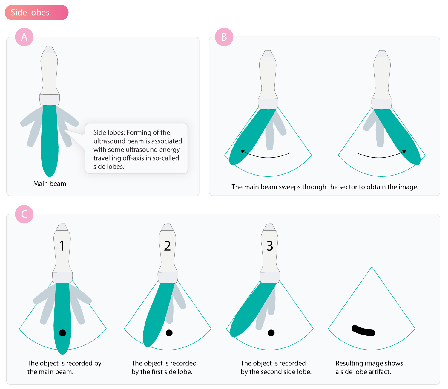 Artifacts in ultrasound imaging