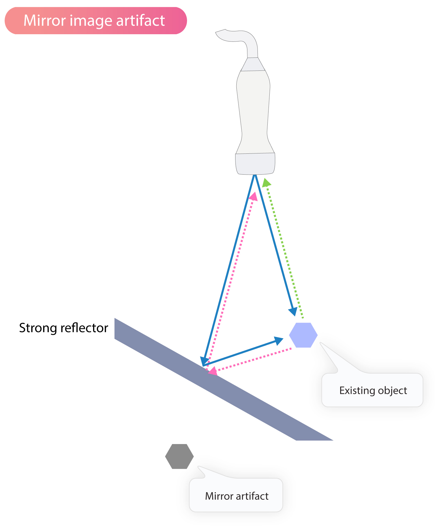 Artifacts in ultrasound imaging