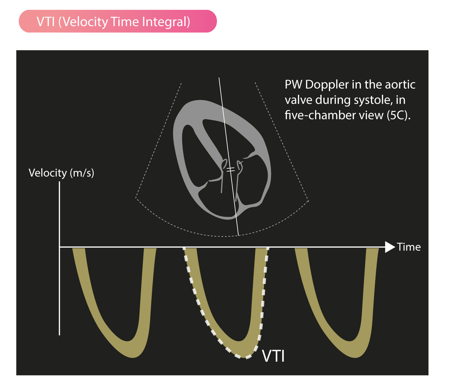 Stroke Volume, VTI (Velocity Time Integral) & Cardiac Output
