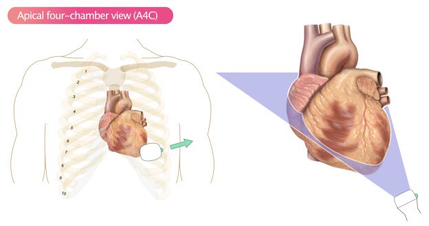 Standard Transthoracic Echocardiogram: Complete Imaging Protocol