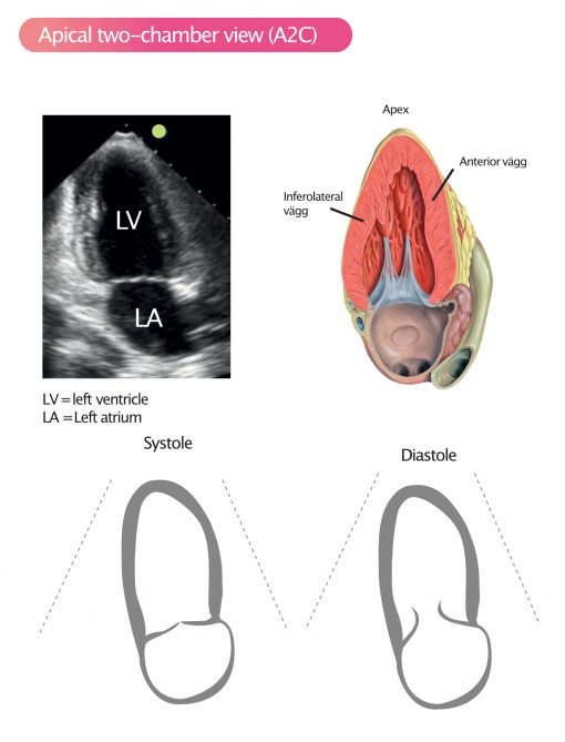 apical-two-chamber-view-a2c-echocardiography-ultrasound-image – The Cardiovascular
