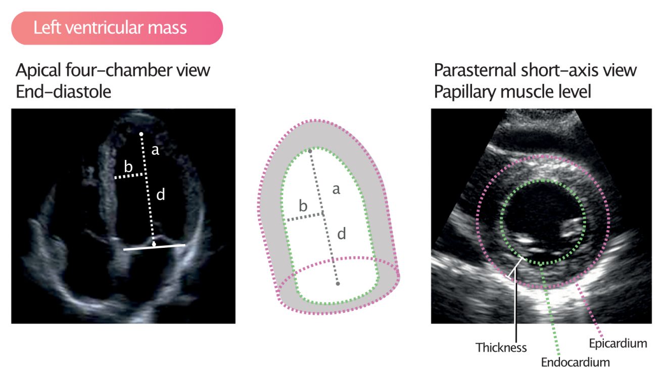 Left ventricular mass and volume (size)