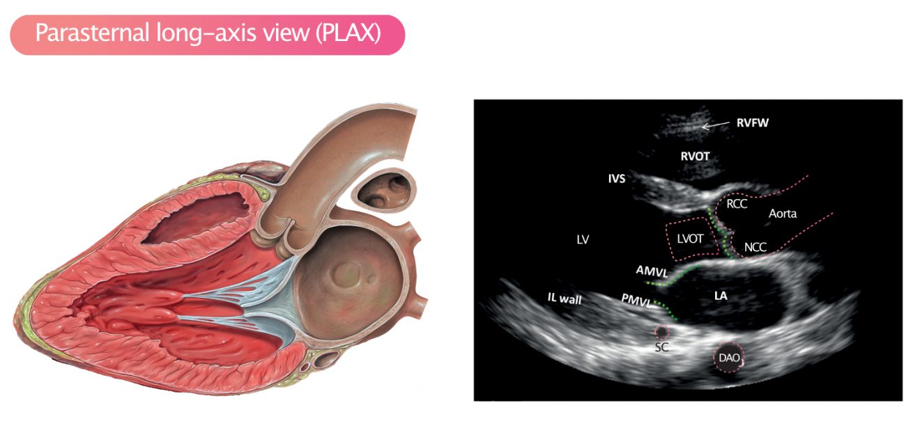 Standard Transthoracic Echocardiogram: Complete Imaging Protocol