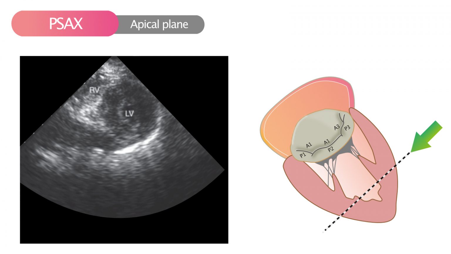 Standard Transthoracic Echocardiogram: Complete Imaging Protocol