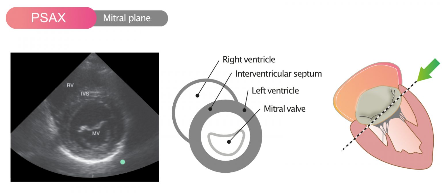 Standard Transthoracic Echocardiogram: Complete Imaging Protocol