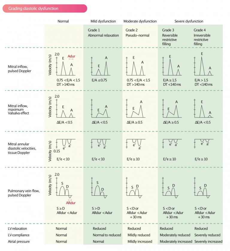 Assessment of diastolic function by echocardiography