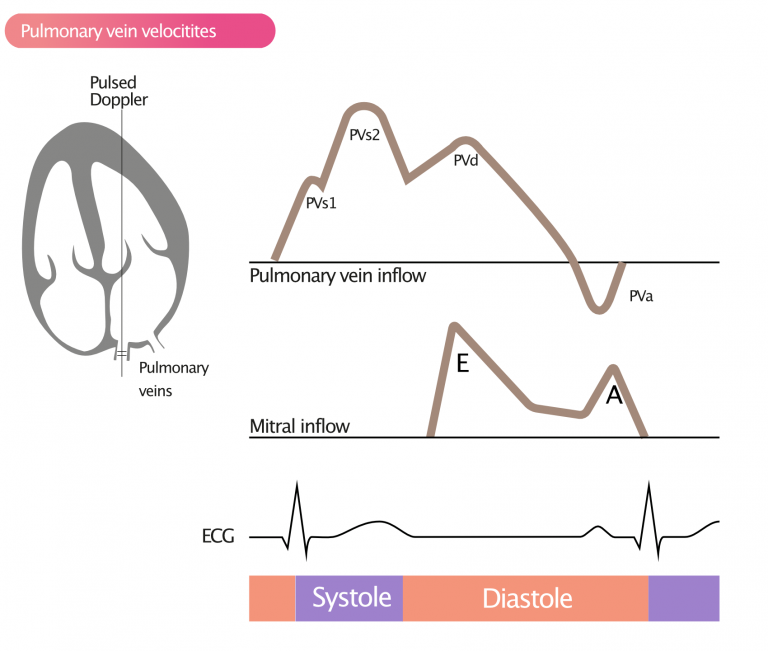 Assessment of diastolic function by echocardiography