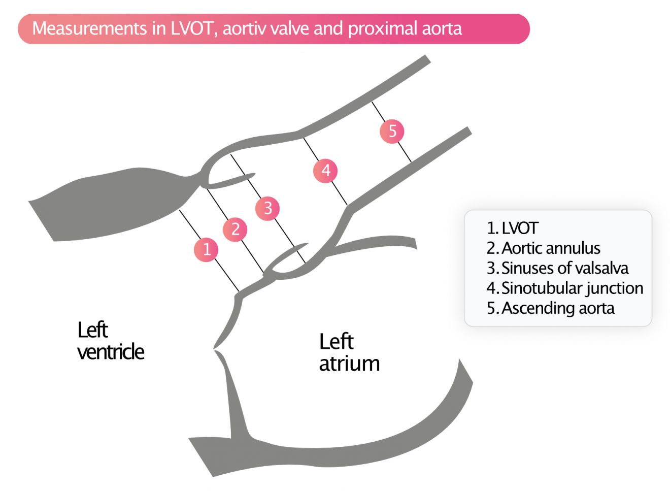 Aortic stenosis - Echocardiography, diagnosis, grading, causes, management