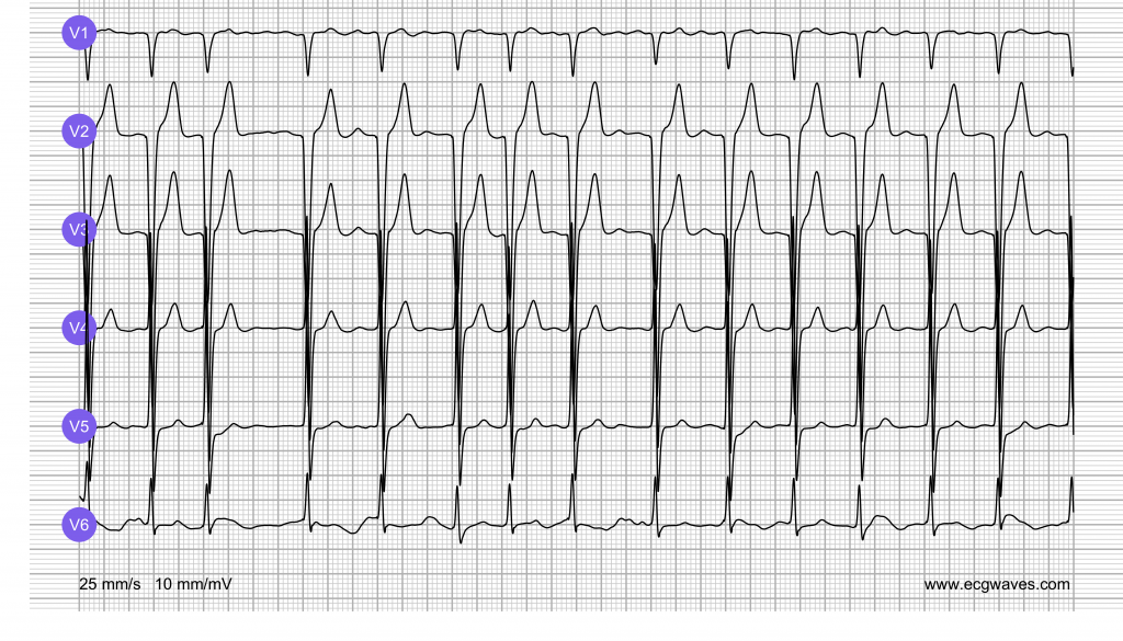 ECG Test (Quiz) Library: Question 2 – The Cardiovascular