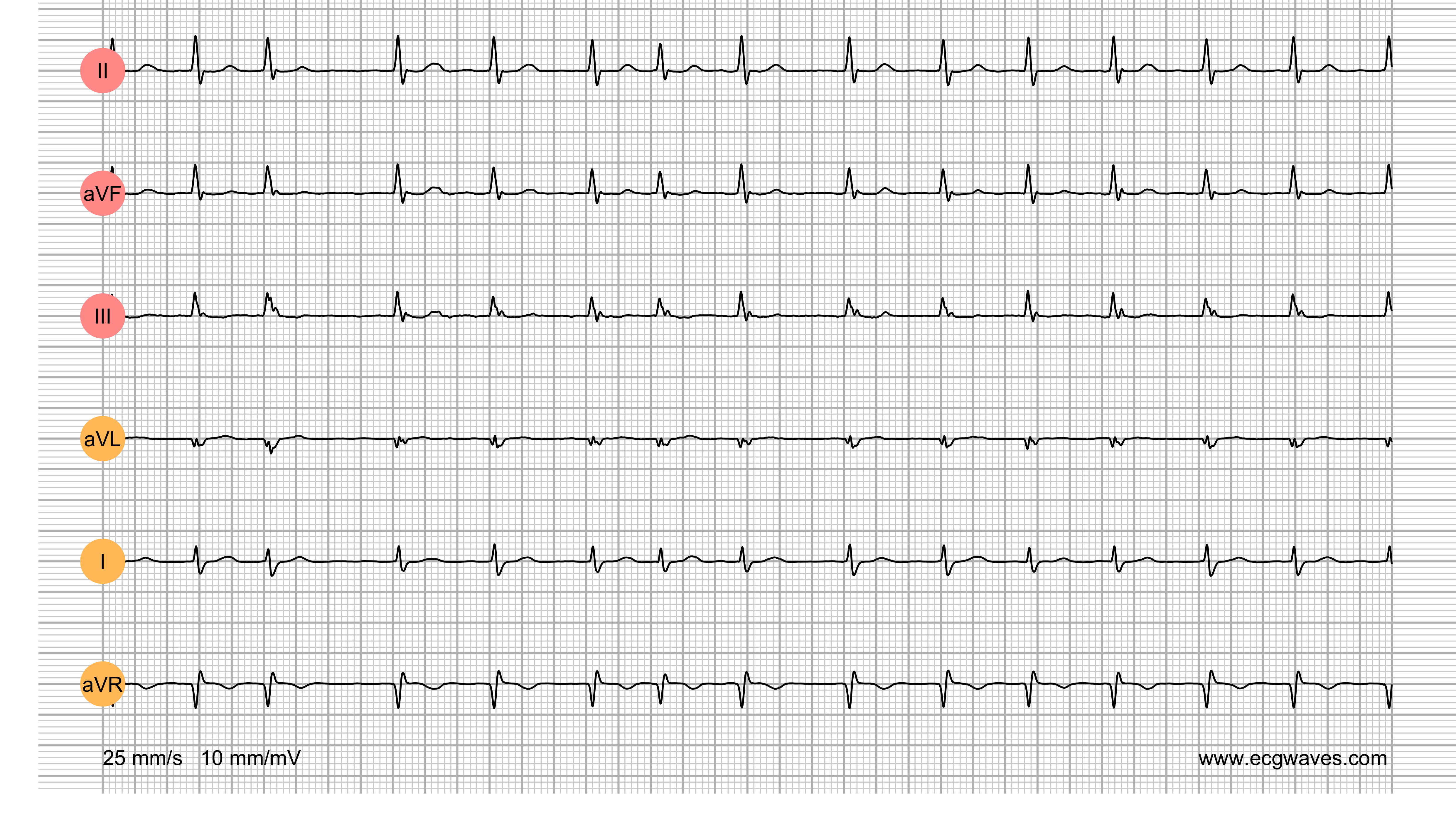 ECG Test (Quiz) Library: Question 2 – The Cardiovascular