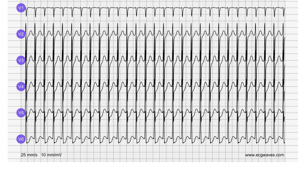 ECG Test (Quiz) Library: Question 7 – The Cardiovascular