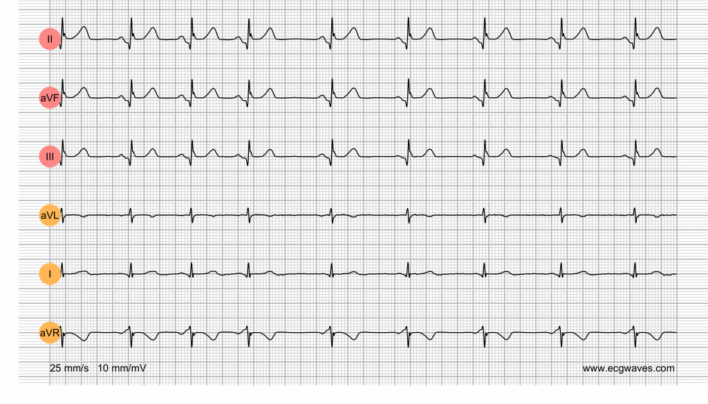 ECG Test (Quiz) Library: Question 8 – The Cardiovascular