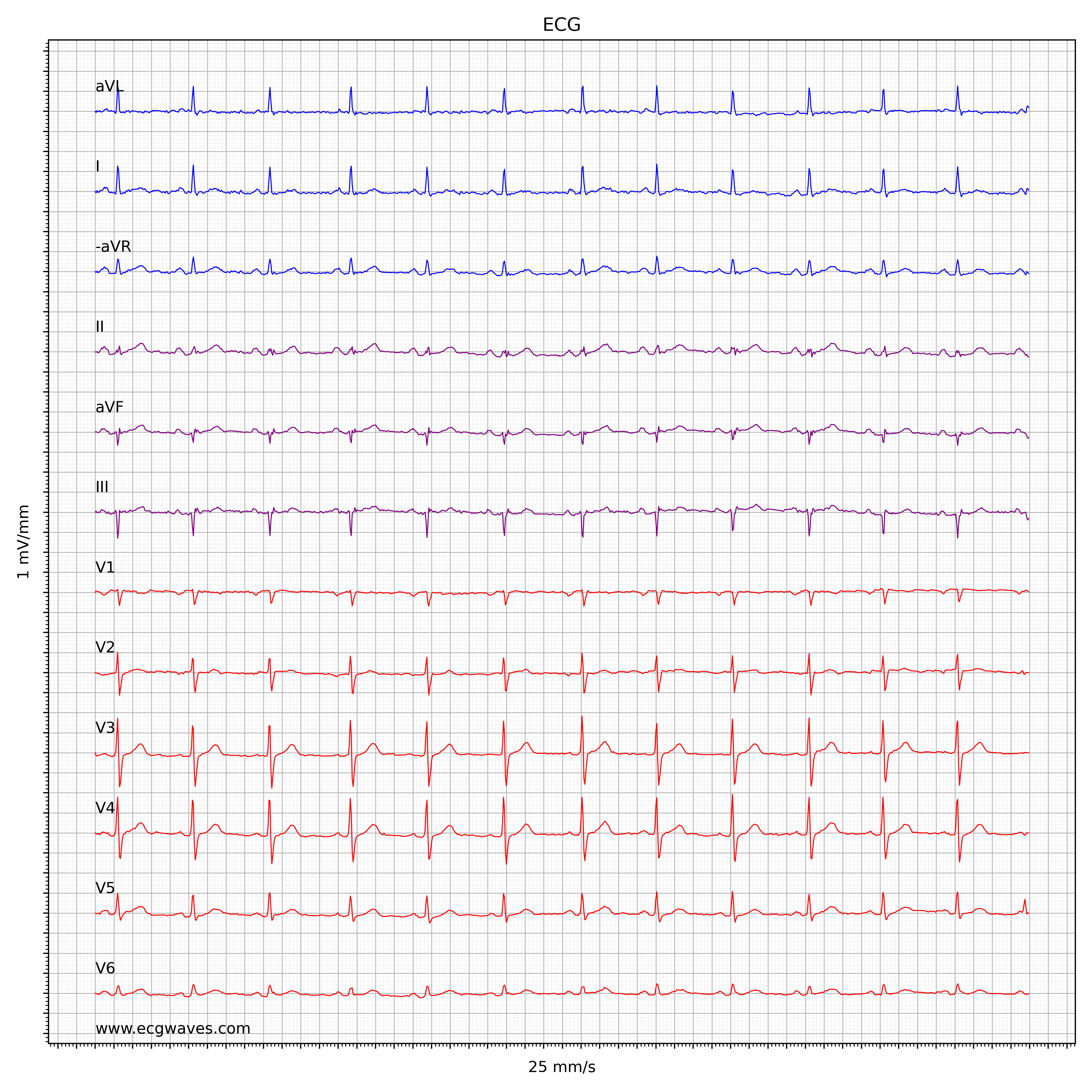 ecg-test-quiz_library_book_course_155361 – The Cardiovascular