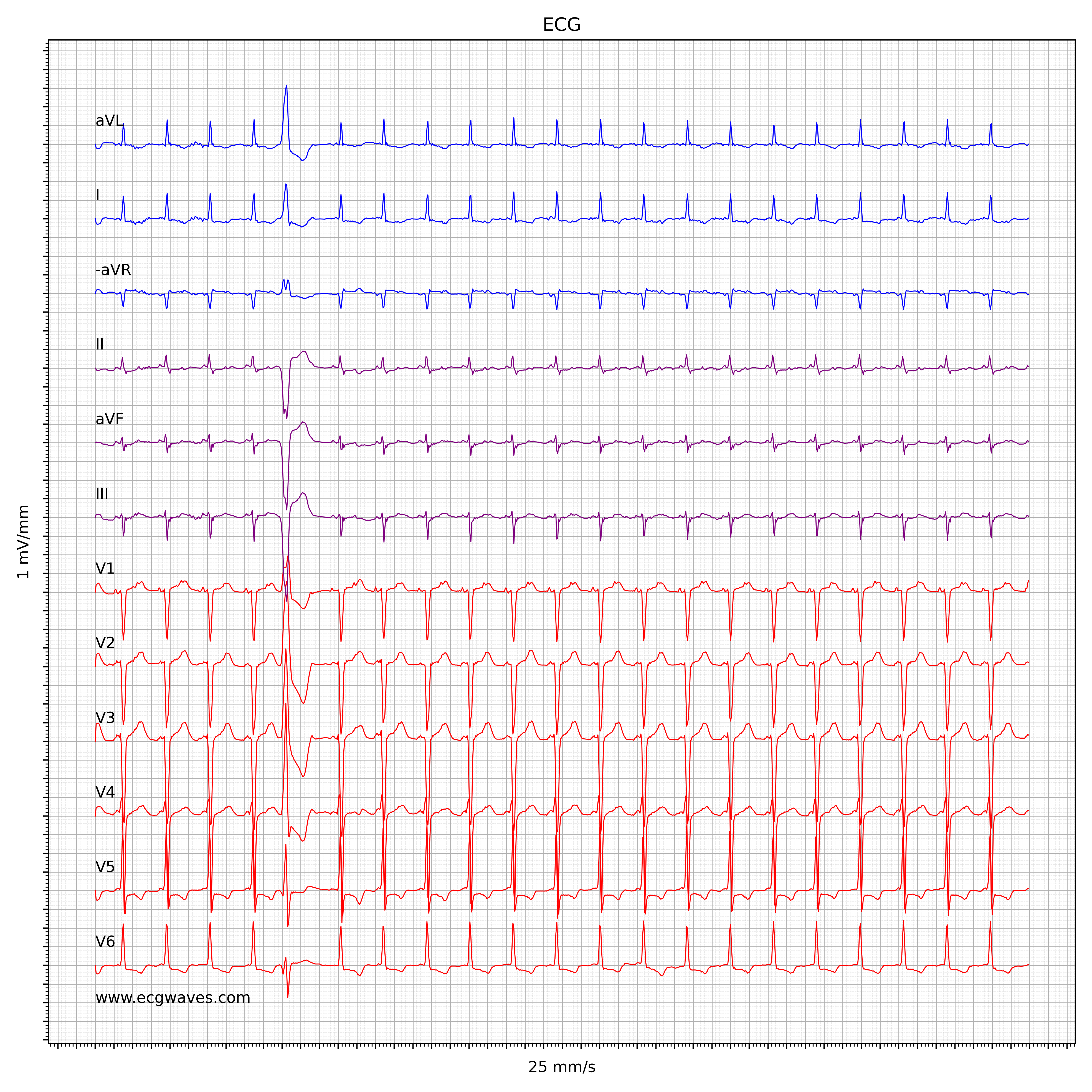 ecg-test-quiz_library_book_course_21766361 – The Cardiovascular