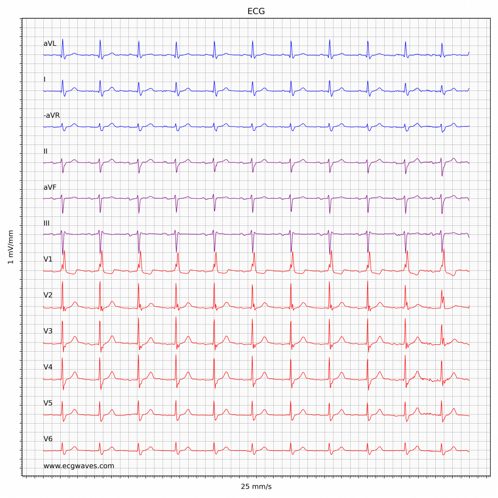 ecg-test-quiz_library_book_course_21812361 – The Cardiovascular