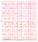 Sinus bradycardia: definitions, ECG, causes and management