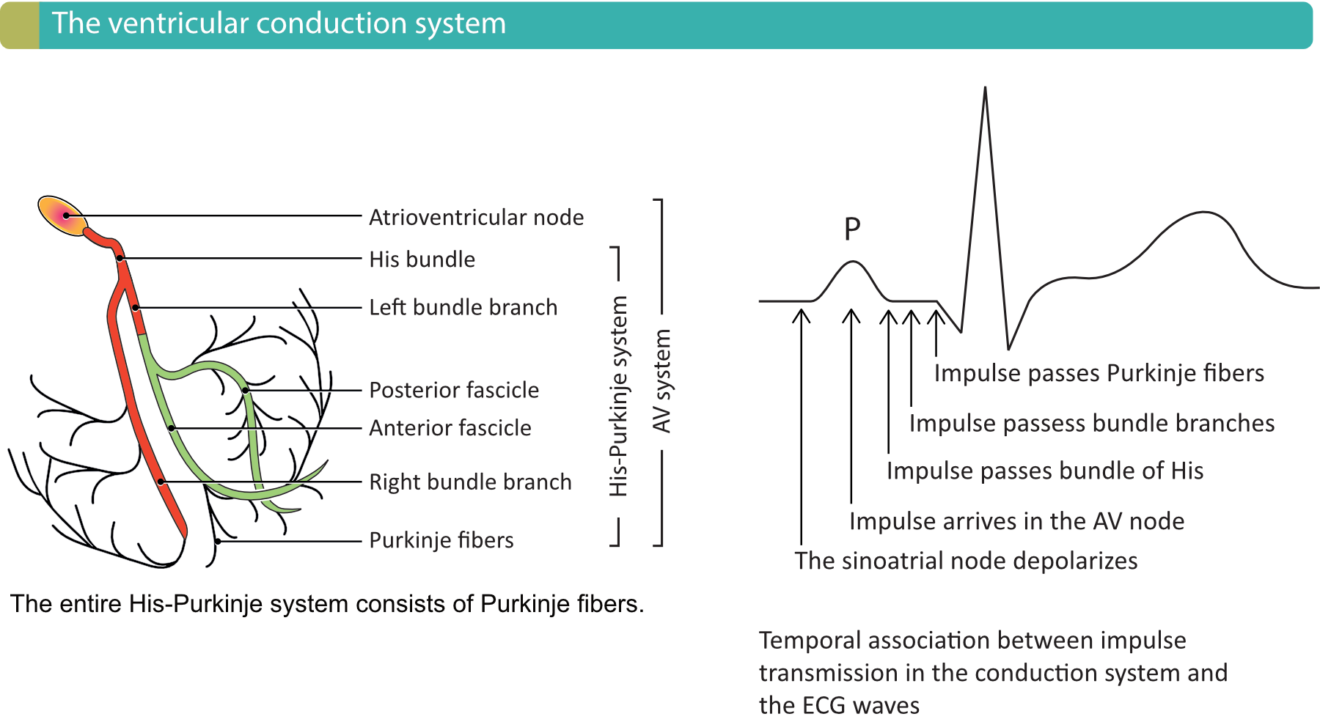 Overview of atrioventricular (AV) blocks